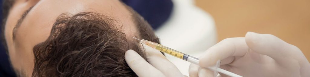 PRP Capilar Ventajas y desventajas - Clinica Capilar Velazquez